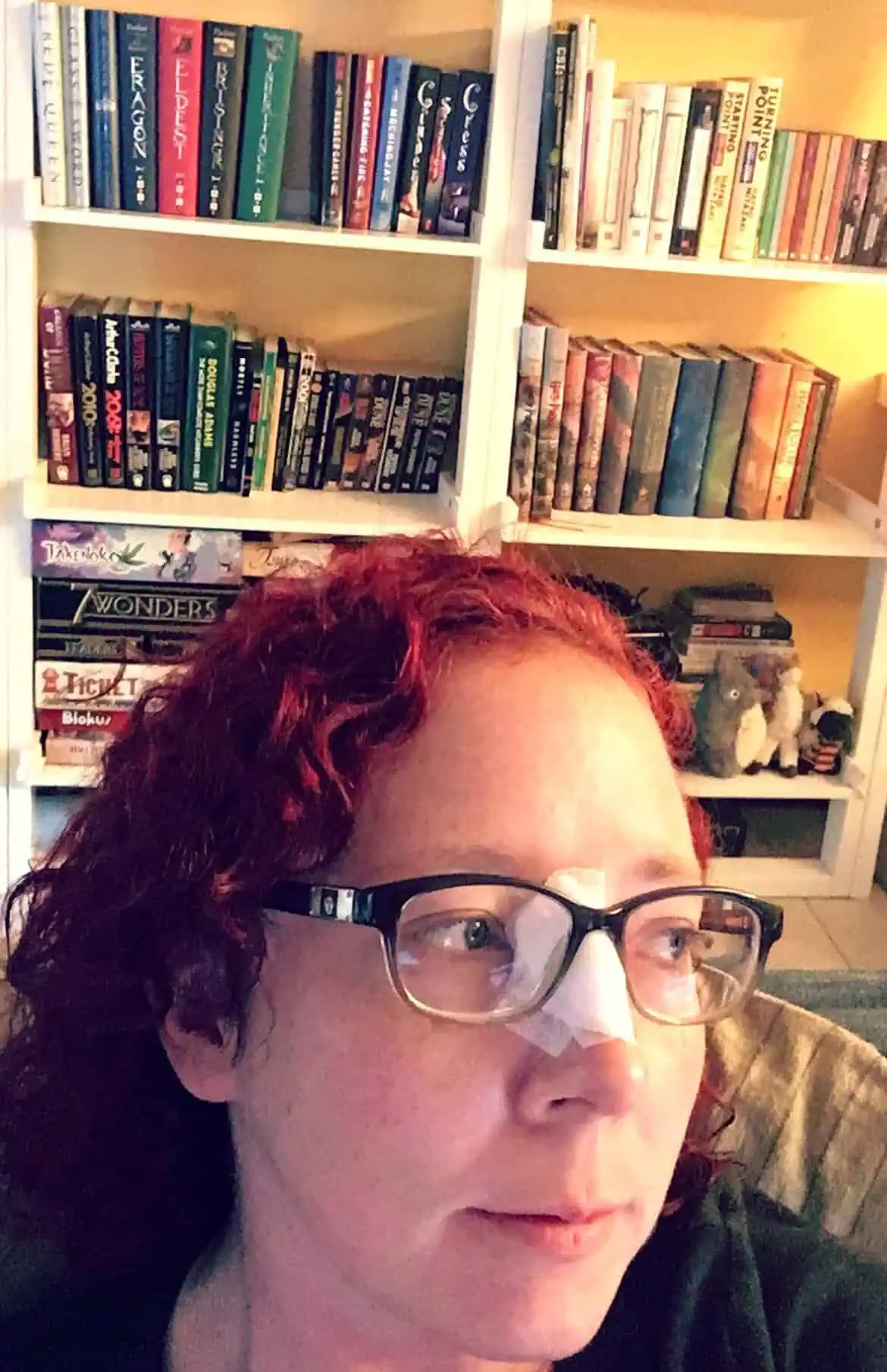 My Skin Cancer Removal - Obligatory Traveler